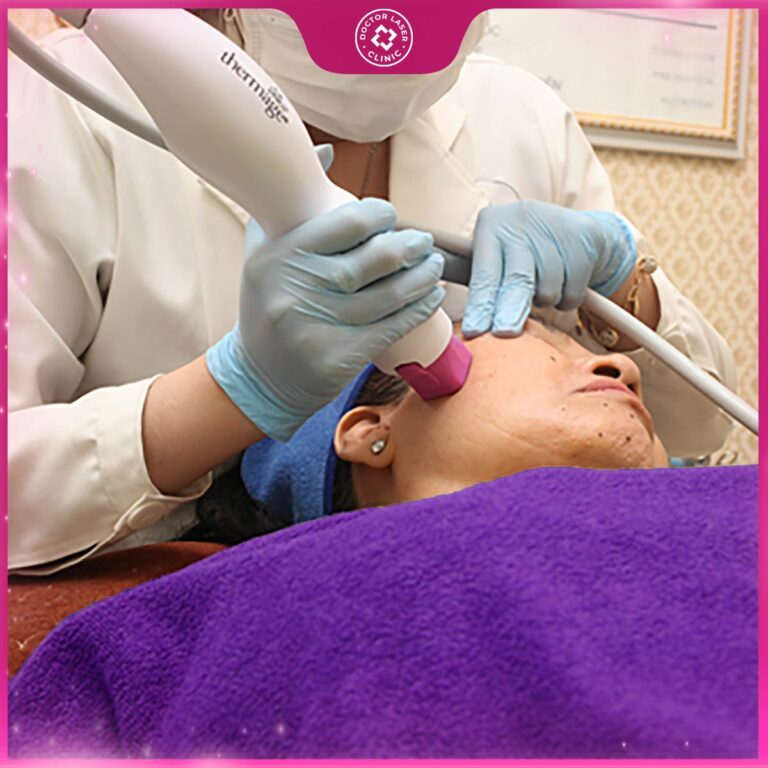 Tan Mỡ Nọng Cằm - Doctor Laser